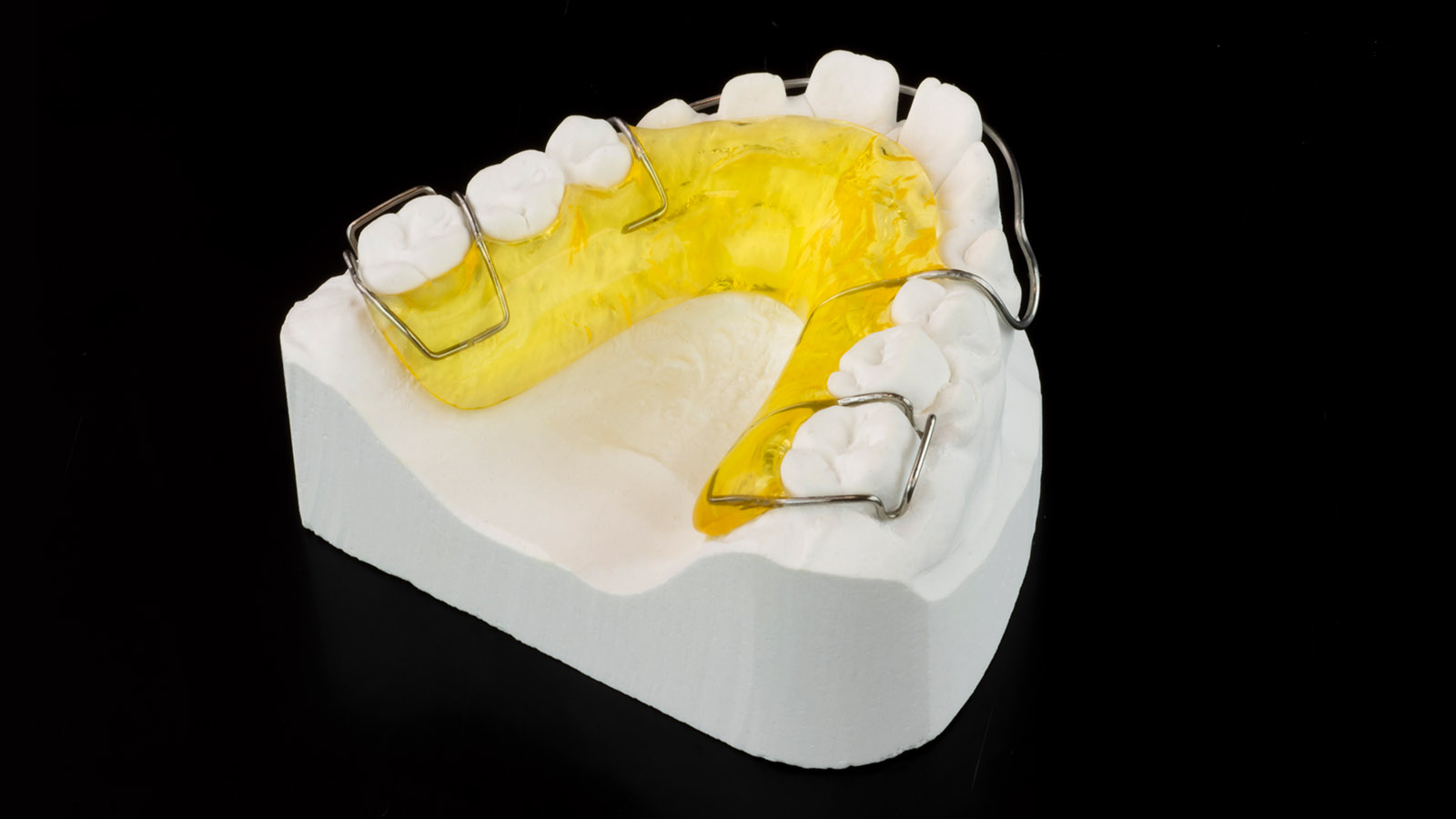 Retaining Appliances | Orthofan Orthodontic Laboratory